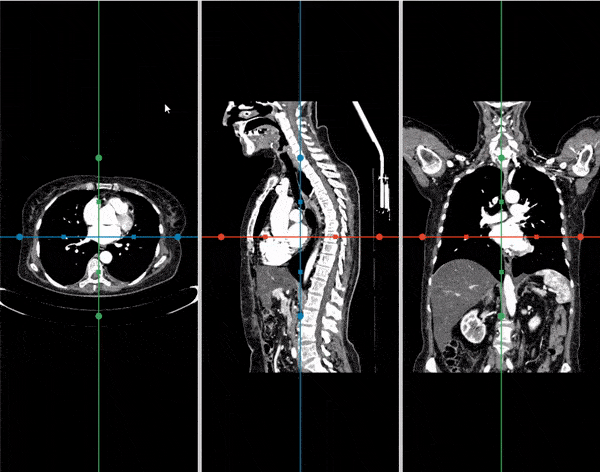 Medical Imaging Visualization | D/Vision Lab